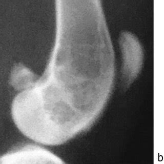 X rays of the defect after the implantation lateral view а group b Download Scientific