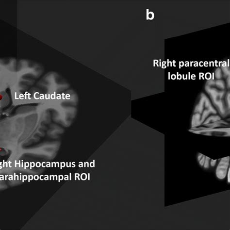 Resting State Connectivity Temporal Functional Connectivity Was Download Scientific Diagram