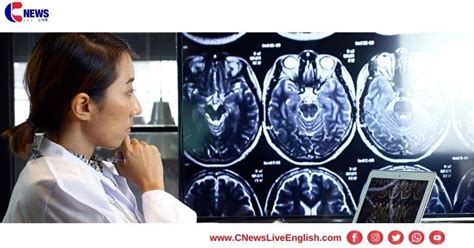 Ai Tool Detects Hidden Epilepsy Brain Lesions Offering Hope For Better Treatment