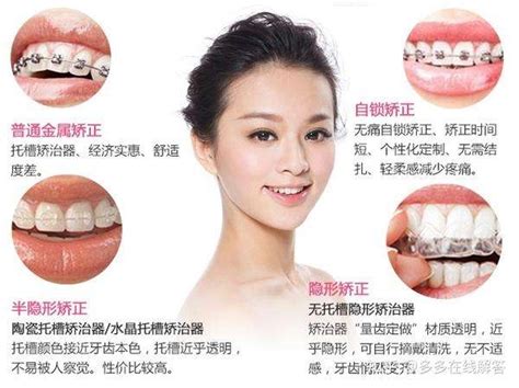 箍牙陶瓷图片 图库 五毛网