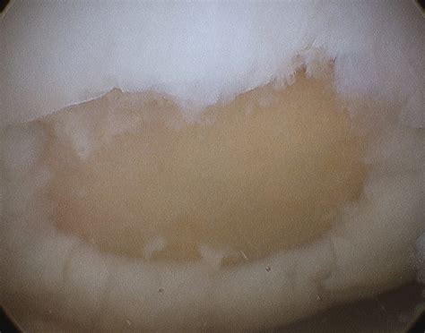 Management The Bone School