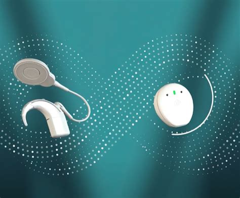 Cochlear Device Processor And Hearing Implants Blogs Cochlear Pronews