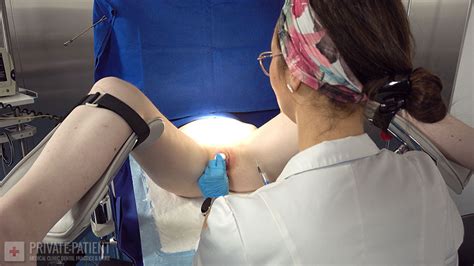 Monitoring Private Patient Com