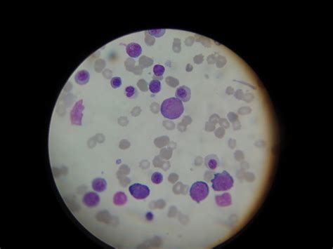 Próeritroblasto a photo on Flickriver