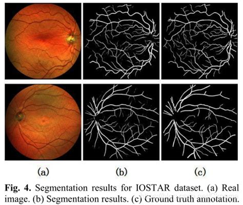 《dense Residual Network For Retinal Vessel Segmentation》fused Residual Attention Dense Double U