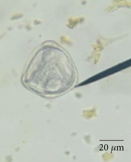 Parasite Oocyst Eggs Of Sheep A Eimeria Spp ×400 B Download Scientific Diagram