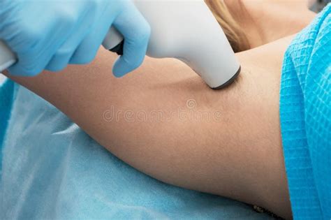Procedure Against Hyperhidrosis Stock Image Image Of Healthy Body