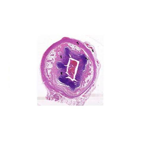 Appendix Histology