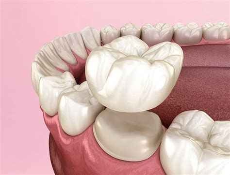 Advanced And Modern Dental Technology In Wildomar