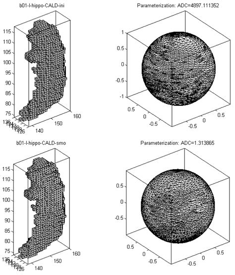 Spherical Parameterization SPHARM MAT V Documentation