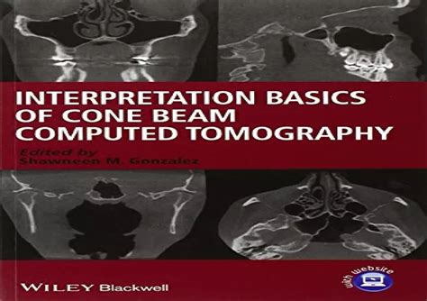 Ppt Pdf Interpretation Basics Of Cone Beam Computed Tomography Free Powerpoint Presentation
