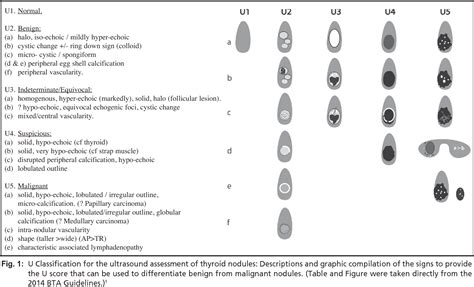 Pdf Reliability Of The Ultrasound Classification System Of Thyroid My Xxx Hot Girl