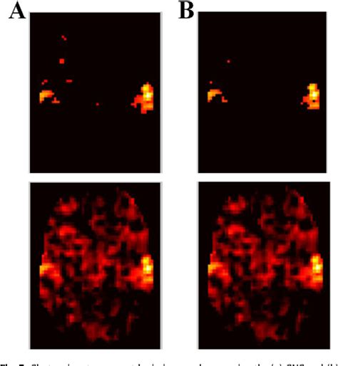 Figure 7 From Clustering Fmri Data With A Robust Unsupervised Learning