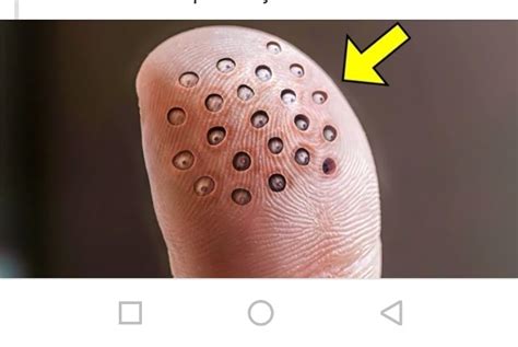 Man Has Weird Round Spots On Finger When The Doctors See It They Call The Cops