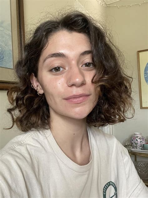 It Gets Better — Doxycycline R Perioral Dermatitis