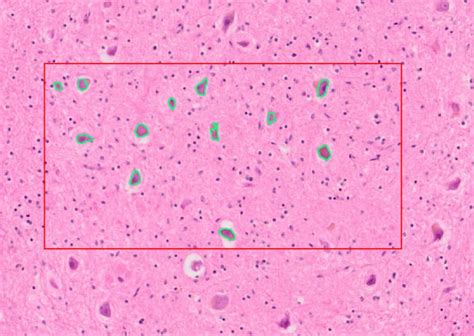 Cell Detection Using A Pixel Classifier Image Analysis Imagesc Forum