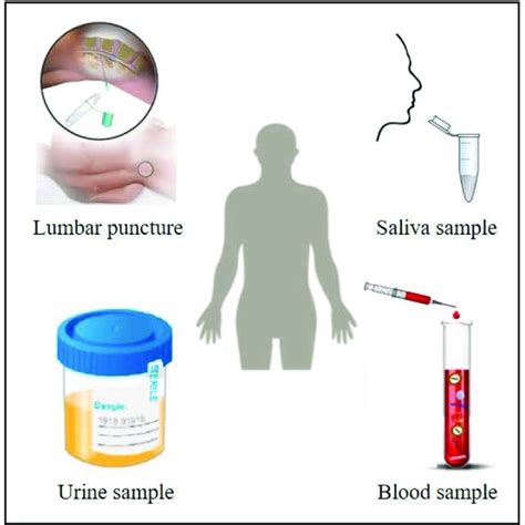 Sers Detection Of Cancer Biomarkers Using Sers Encoded Nanoparticles