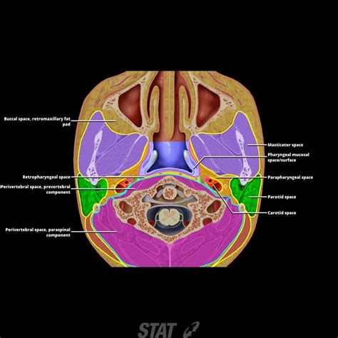 Other Neck Spaces Parapharyngeal Space Ranzcrpart1 Wiki Fandom