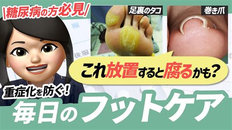 【フットケア】糖尿病患者さん必見！毎日のフットケアで足の病気を回避！ Youtube