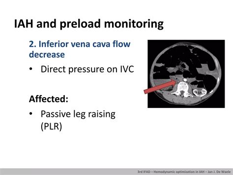 Hemodynamic Optimization In Intra Abdominal Hypertension Ppt