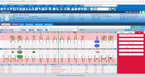 How Do I Access The Charting Module Planet Dds