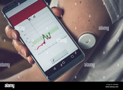 Woman Checking Glucose Level With A Remote Sensor And Mobile Phone New Technology Sensor