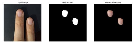 Deeplearning Computervision Pytorch Unet Segmentation Ai