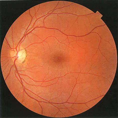 Fovea Centralis Diagram Quizlet