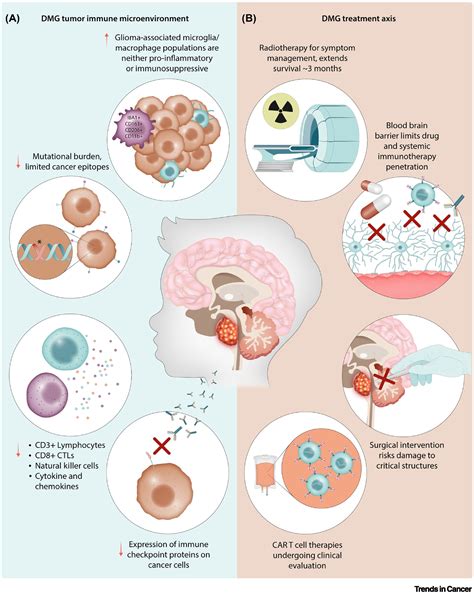 Gliomas In Adults Glioblastoma And Other Gliomas Fact Sheets Yale