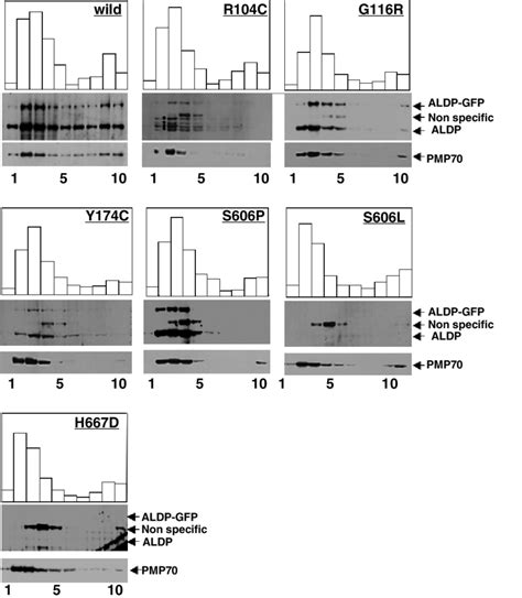 Subcellular Localization Of Wild Type And Mutant Adrenoleukodystrophy Download Scientific