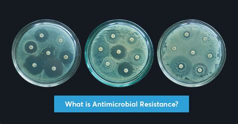 What Is Antimicrobial Resistance Prepladder