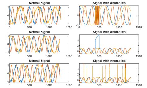 Deepsignalanomalydetectorlstmforecaster Detect Signal Anomalies Using Lstm Forecaster Matlab