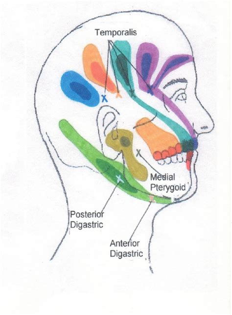 Head Neck And Shoulder Trigger Point Chart 2 © Copyright American