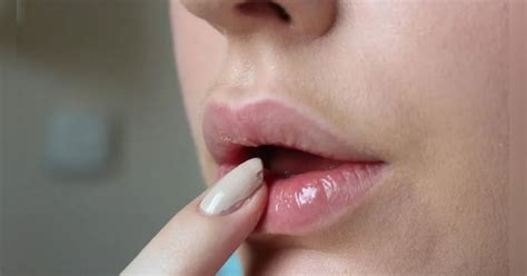 Try These Tips To Remove Dark Circles Around The Lips Due To