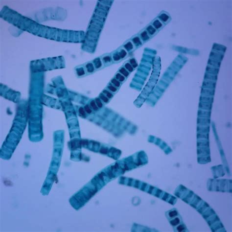 Ulothrix Wm Microscope Slide Southern Biological
