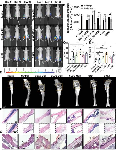 《as》中大张幸鼎 温州医大邓俊杰：基于骨细胞裂解物的水凝胶用于调节成骨细胞 破骨细胞稳态以增强骨修复 腾讯新闻