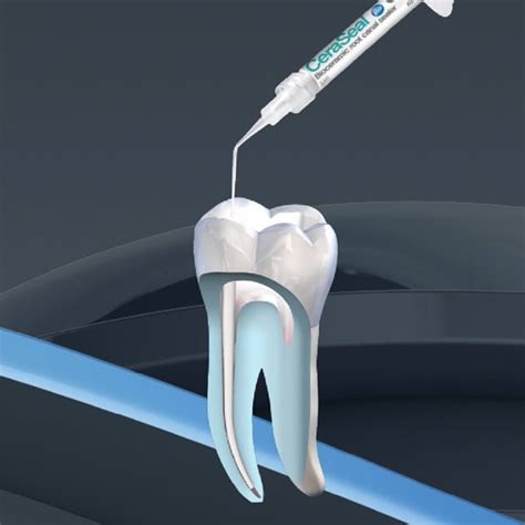 Komet France Materiel Endodontie