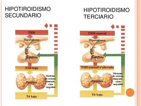 Hipotiroidismo Primario Y Secundario Porn Sex Picture