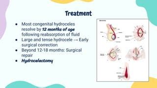 Undescended Testes Hydrocele Testicular Torsionpdf