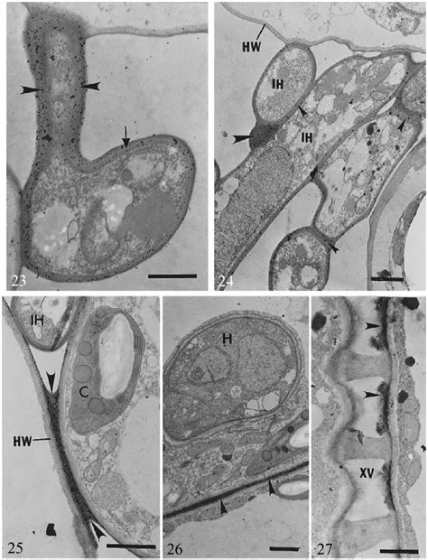 24 Rust Infected Leaf Tissue Of E Peplus Following Treatment With