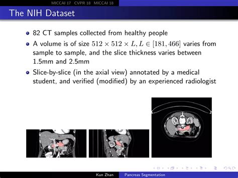 Pancreas Segmentation Ppt