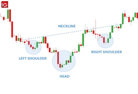 Head And Shoulders Pattern Ke Parts