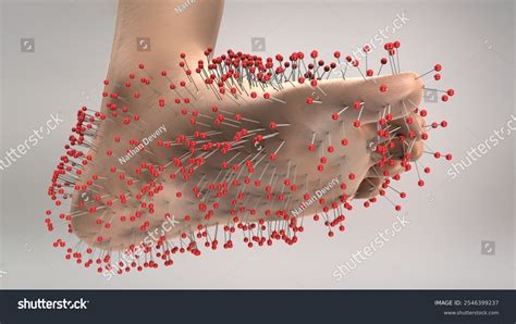 Peripheral Neuropathy Illustration Pins Needles Foot Stock Illustration