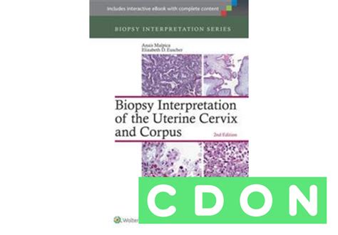 Biopsy Interpretation Of The Uterine Cervix And Corpus 9781451192964