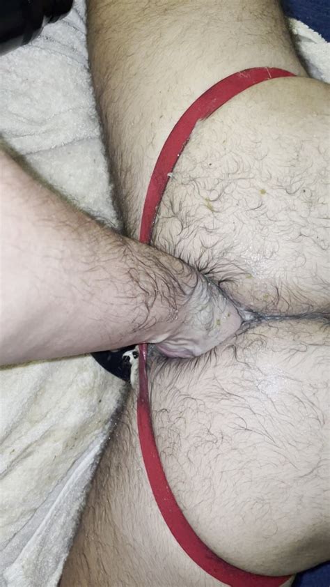 Fisting A Stretched Hole Cumdump Thisvid Com