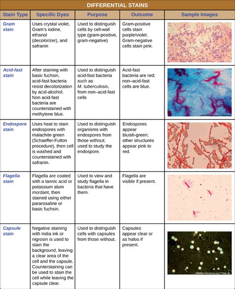Acid Fast Staining Lab Report Maramintrujillo