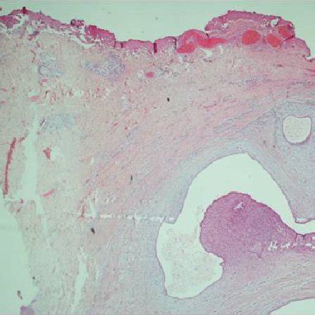 Standing Spinal X Rays Shows A Compression Fracture Of T7 Vertebral Download Scientific Diagram