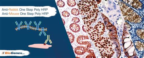 Biogenex On Linkedin Biogenex Detectionsystems Rabbitonesteppoly