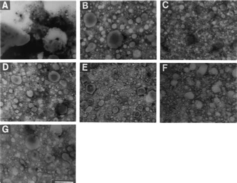 Light Micrographs Of Model Processed Cheese Samples From The Single
