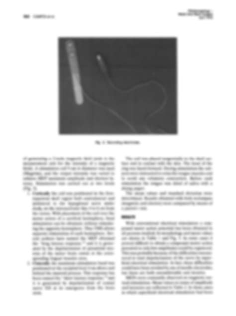 Solution Campos1995 Nerve Conduction Velocity Electromyography